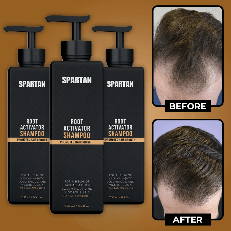 Spartan - Root Activator Shampoo